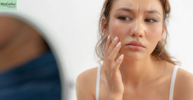 The Science Behind Skin Sensitivity: How It Affects Your Barrier ...